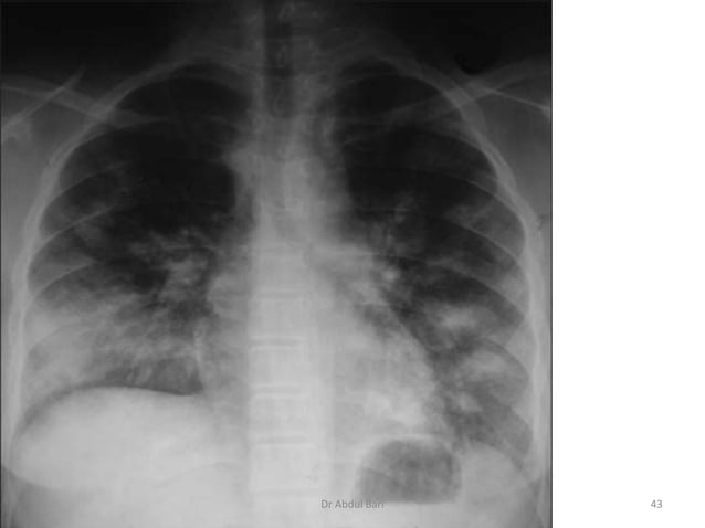 chest-x-ray-teaching-tutorial.pptx