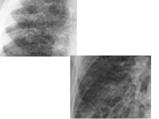 chest-x-ray-teaching-tutorial.pptx