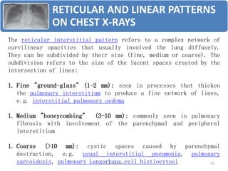 chest-x-ray-teaching-tutorial.pptx