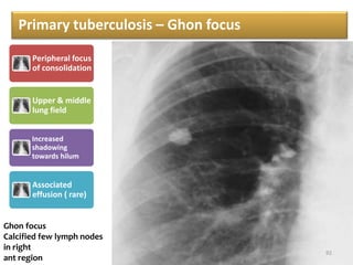 chest-x-ray-teaching-tutorial.pptx
