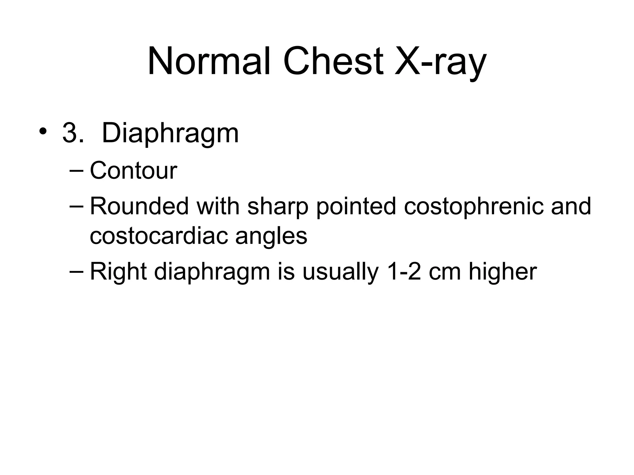 Chest X Ray Interpretation | PPT