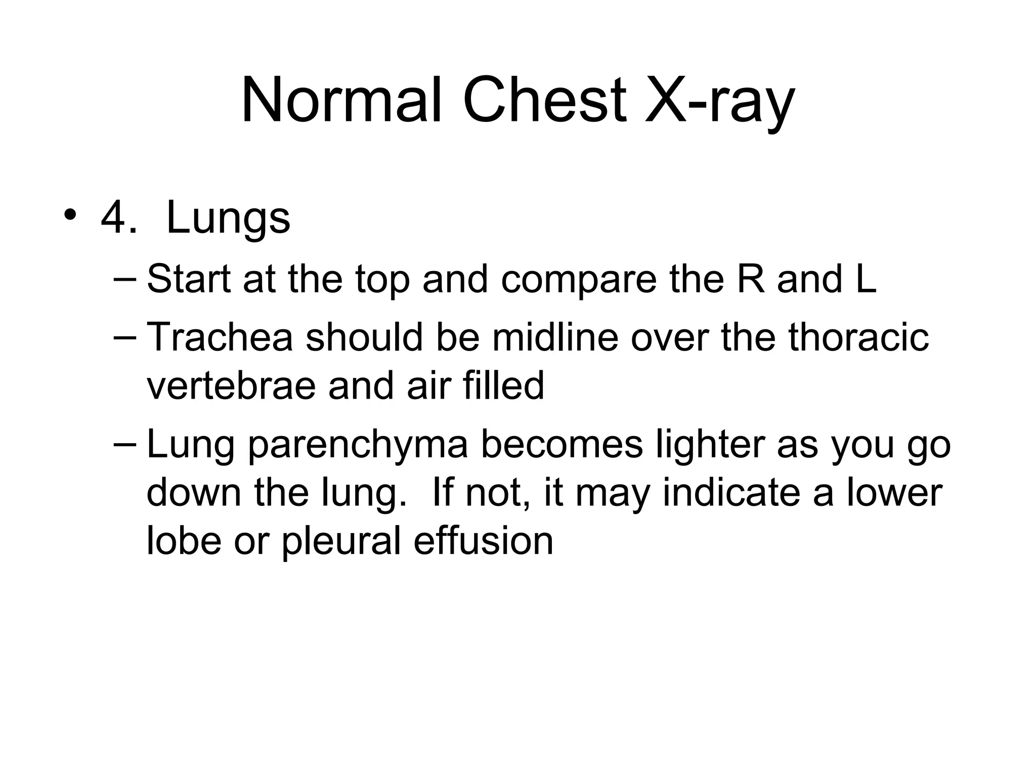 Chest X Ray Interpretation | PPT