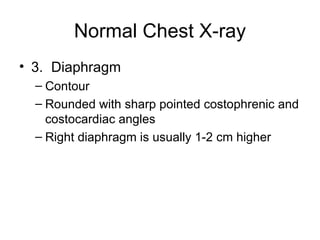 Chest X Ray Interpretation | PPT