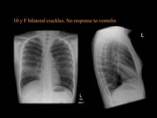 Radiology: Chest Imaging | PPT