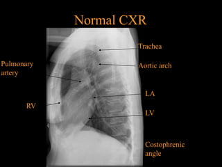 Radiology: Chest Imaging | PPT