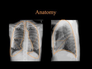 Radiology: Chest Imaging | PPT