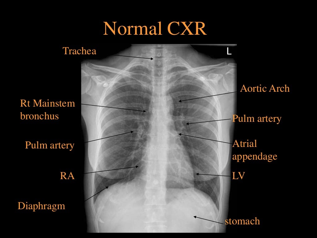 Radiology: Chest Imaging