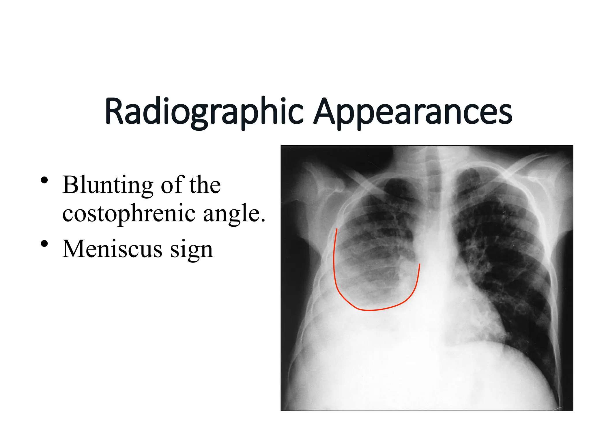 CHEST interpretiation with example (2).pptx