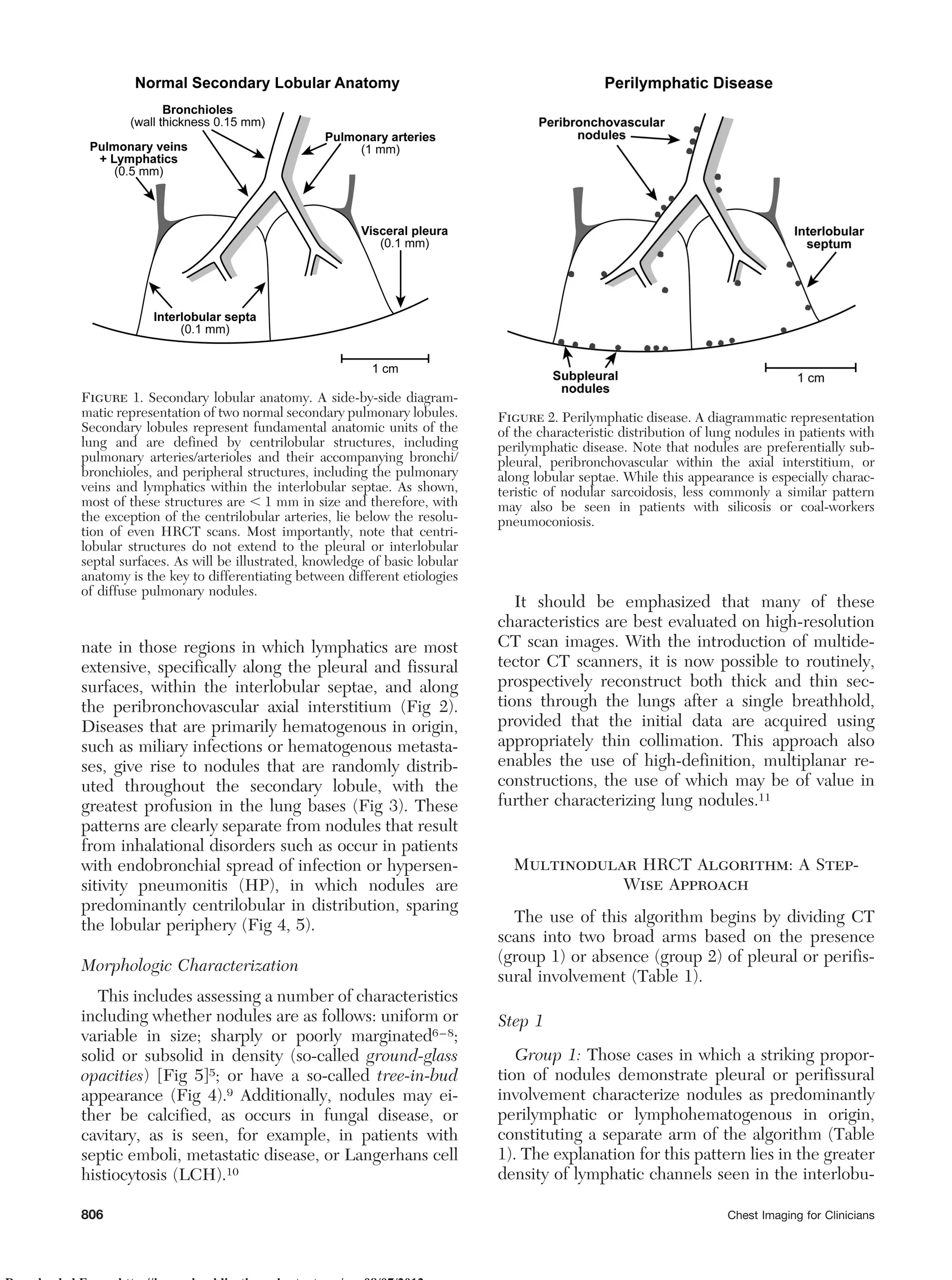 revision de ensayo sobre enfermedad multinodular.pdf