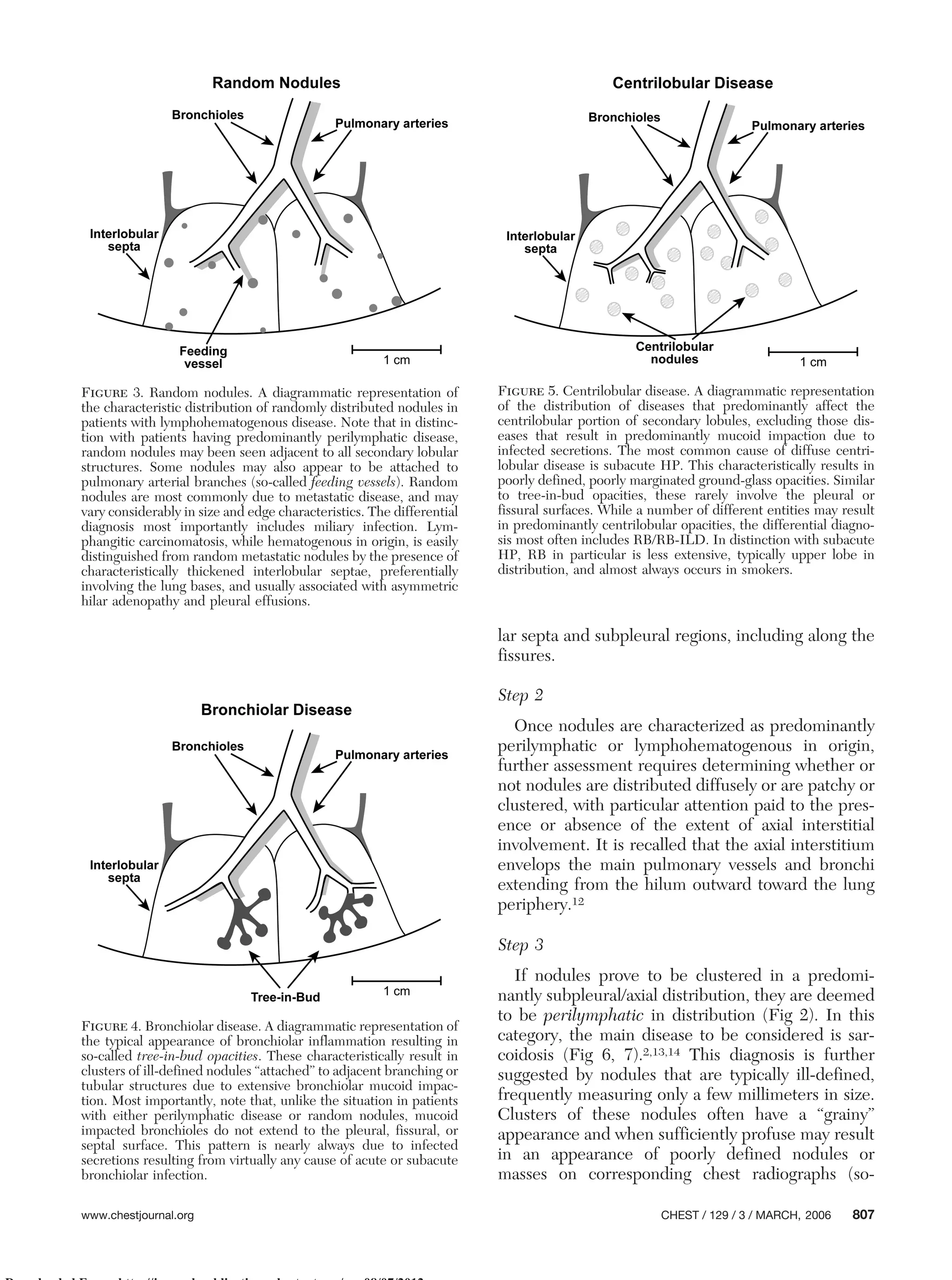 revision de ensayo sobre enfermedad multinodular.pdf