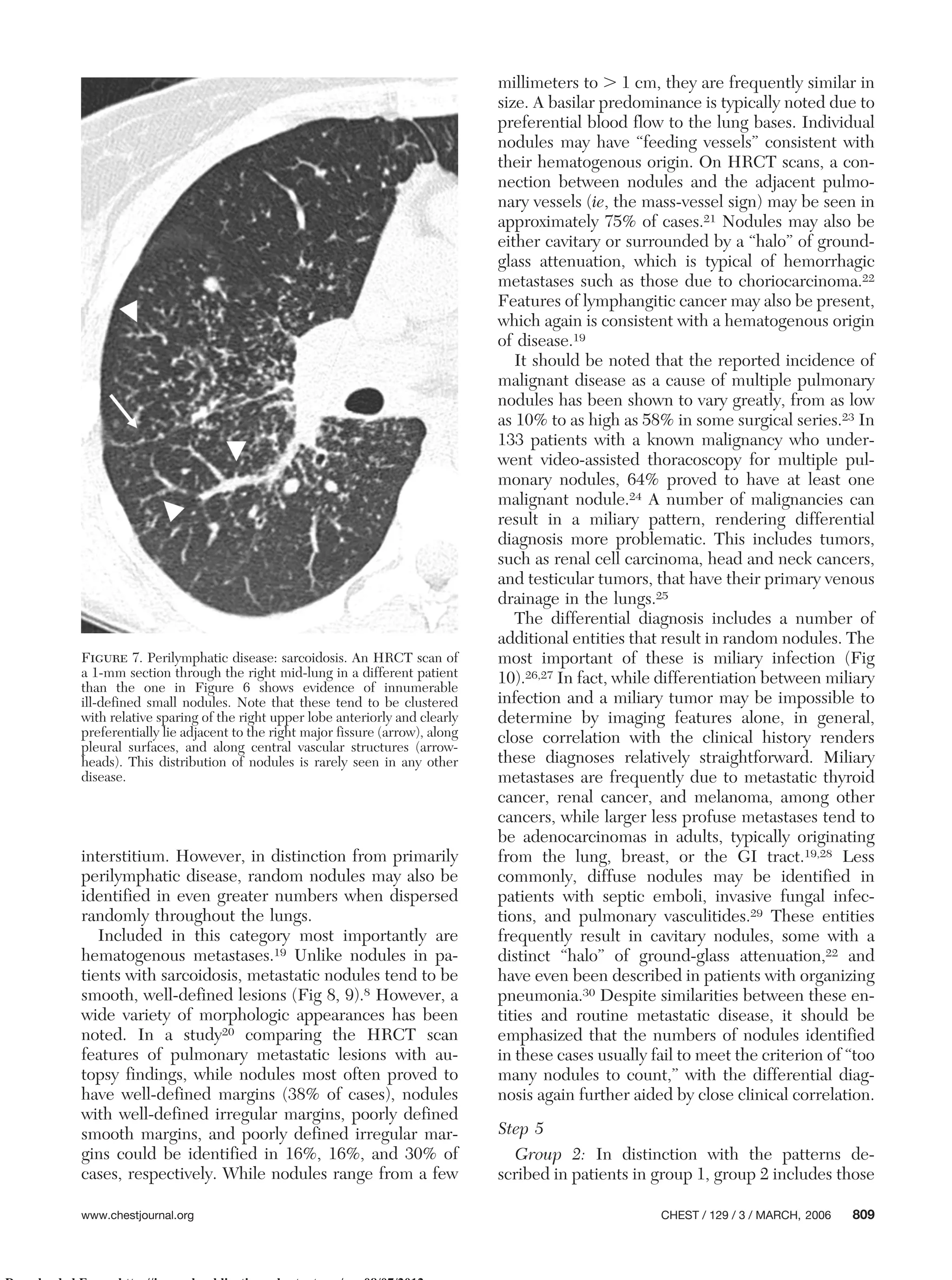 revision de ensayo sobre enfermedad multinodular.pdf