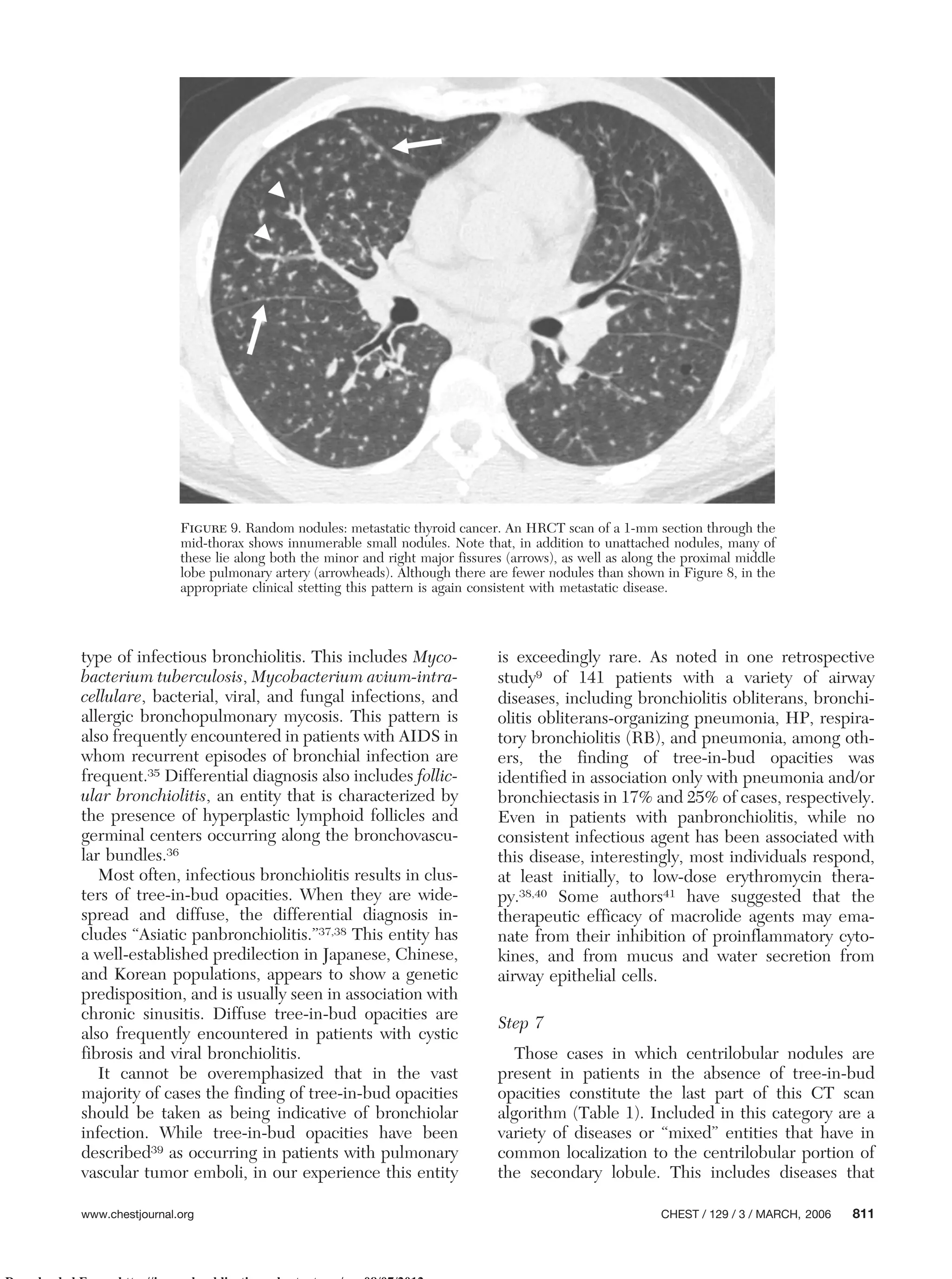 revision de ensayo sobre enfermedad multinodular.pdf