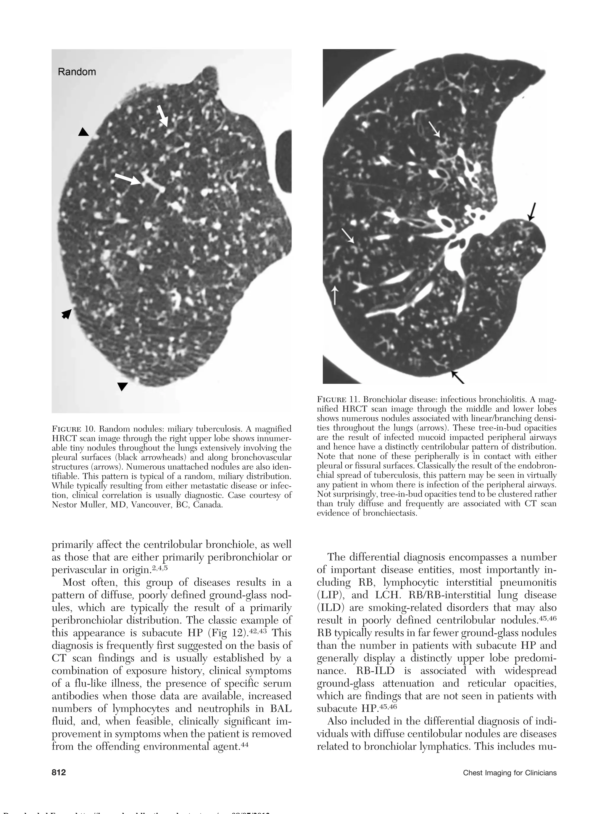 revision de ensayo sobre enfermedad multinodular.pdf