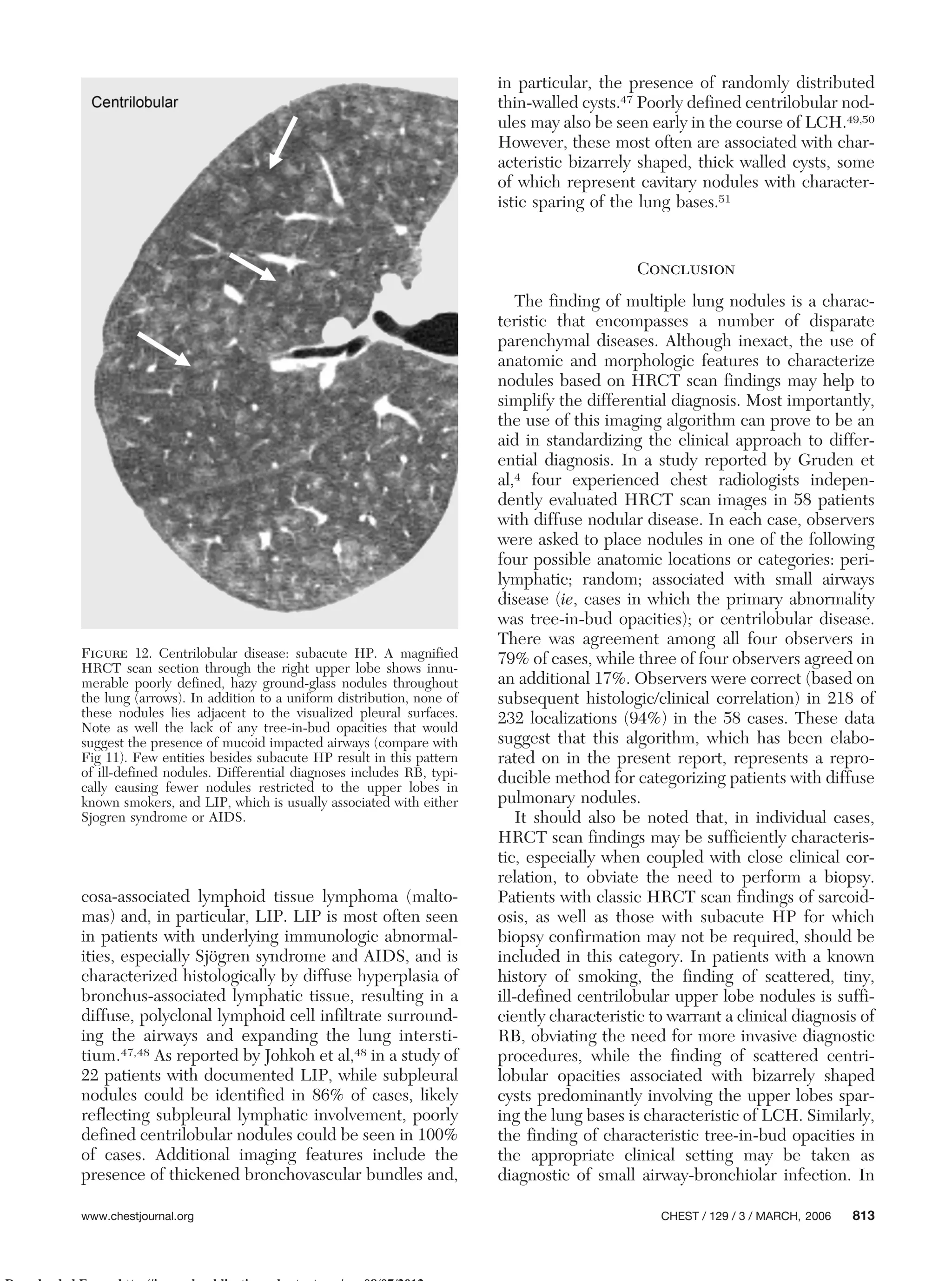 revision de ensayo sobre enfermedad multinodular.pdf