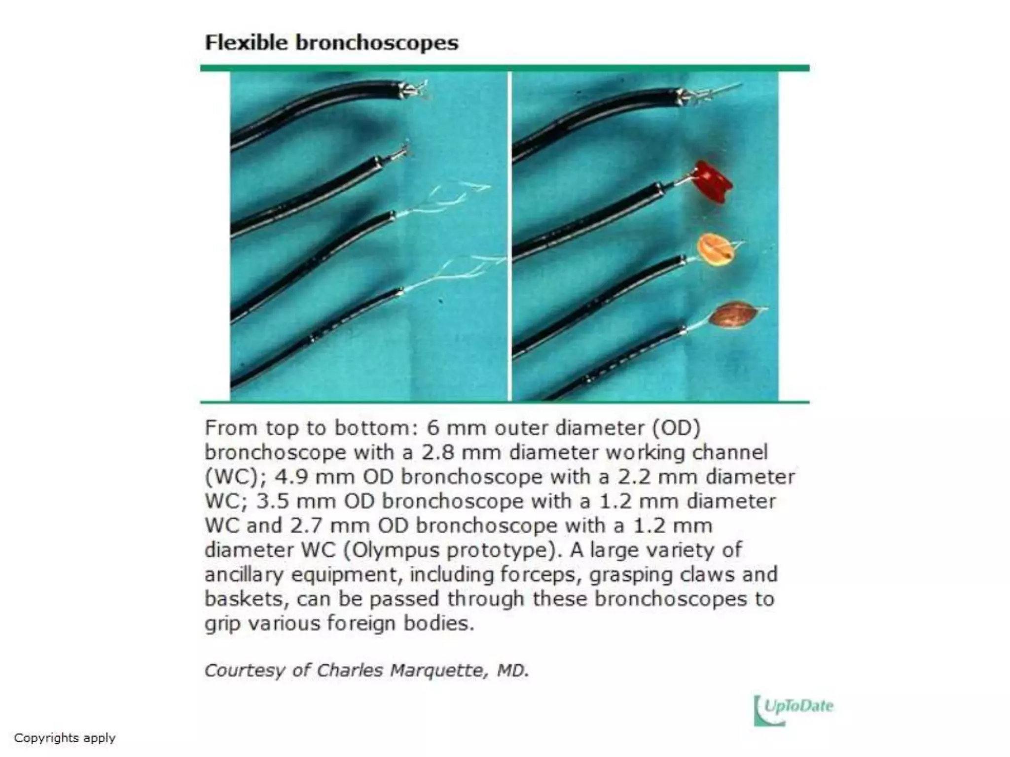 Management Of Foreign Body Aspiration (FBA) And Central Airway ...