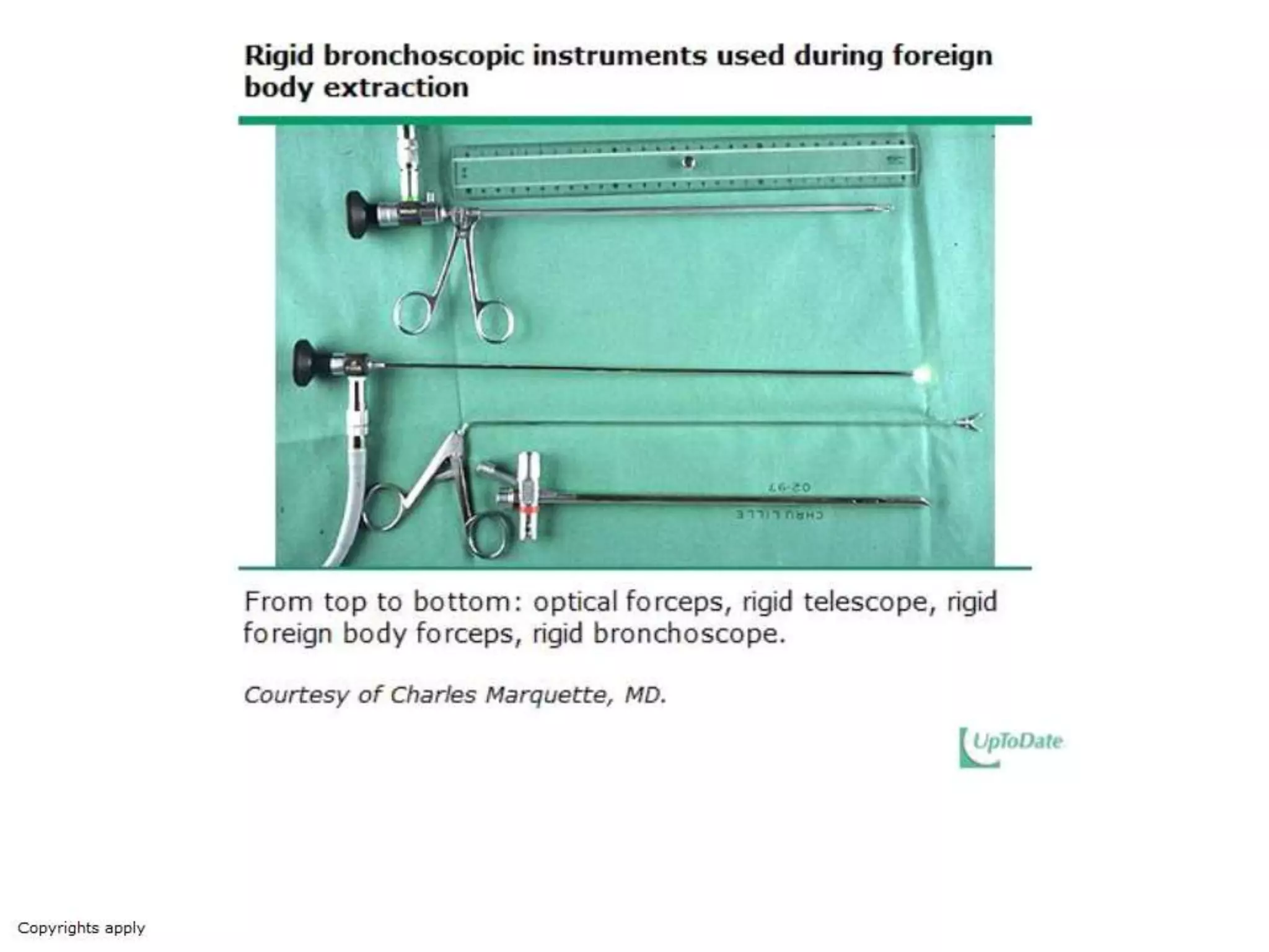 Management Of Foreign Body Aspiration (FBA) And Central Airway ...