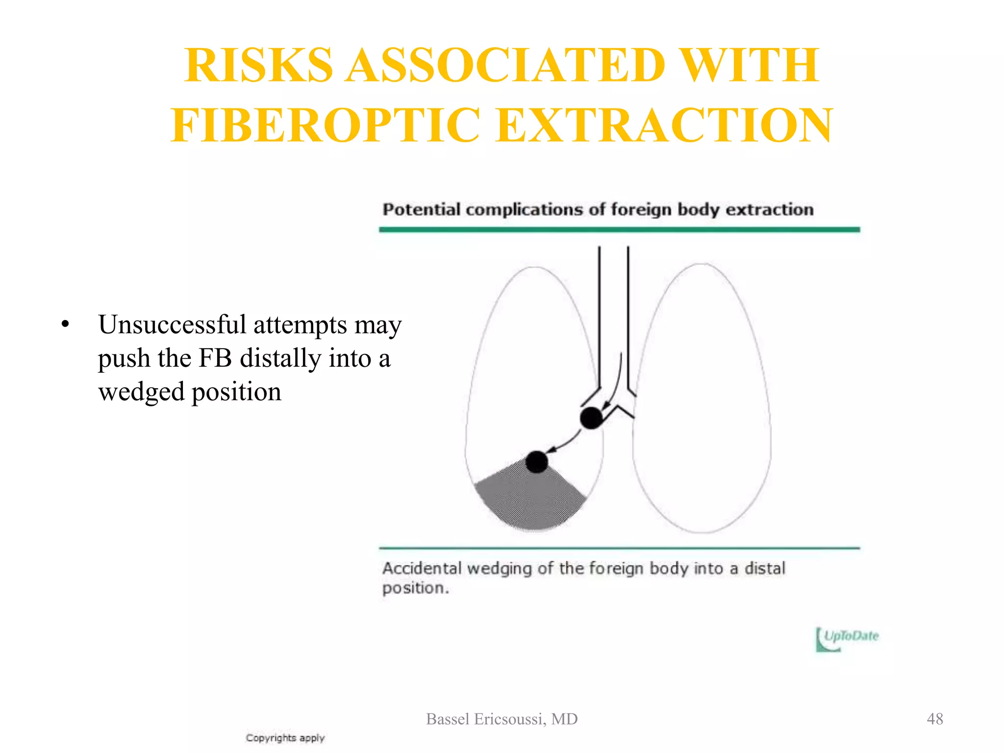 Management Of Foreign Body Aspiration (FBA) And Central Airway ...