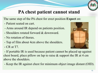 Chest 2_b3ca9e62dffa3e038b60dddc8be8f96c.pdf