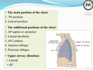 Chest 2_b3ca9e62dffa3e038b60dddc8be8f96c.pdf