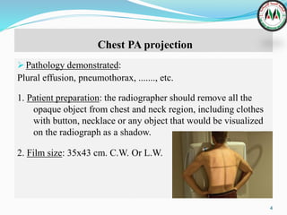 Chest 2_b3ca9e62dffa3e038b60dddc8be8f96c.pdf