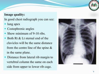 Chest 2_b3ca9e62dffa3e038b60dddc8be8f96c.pdf