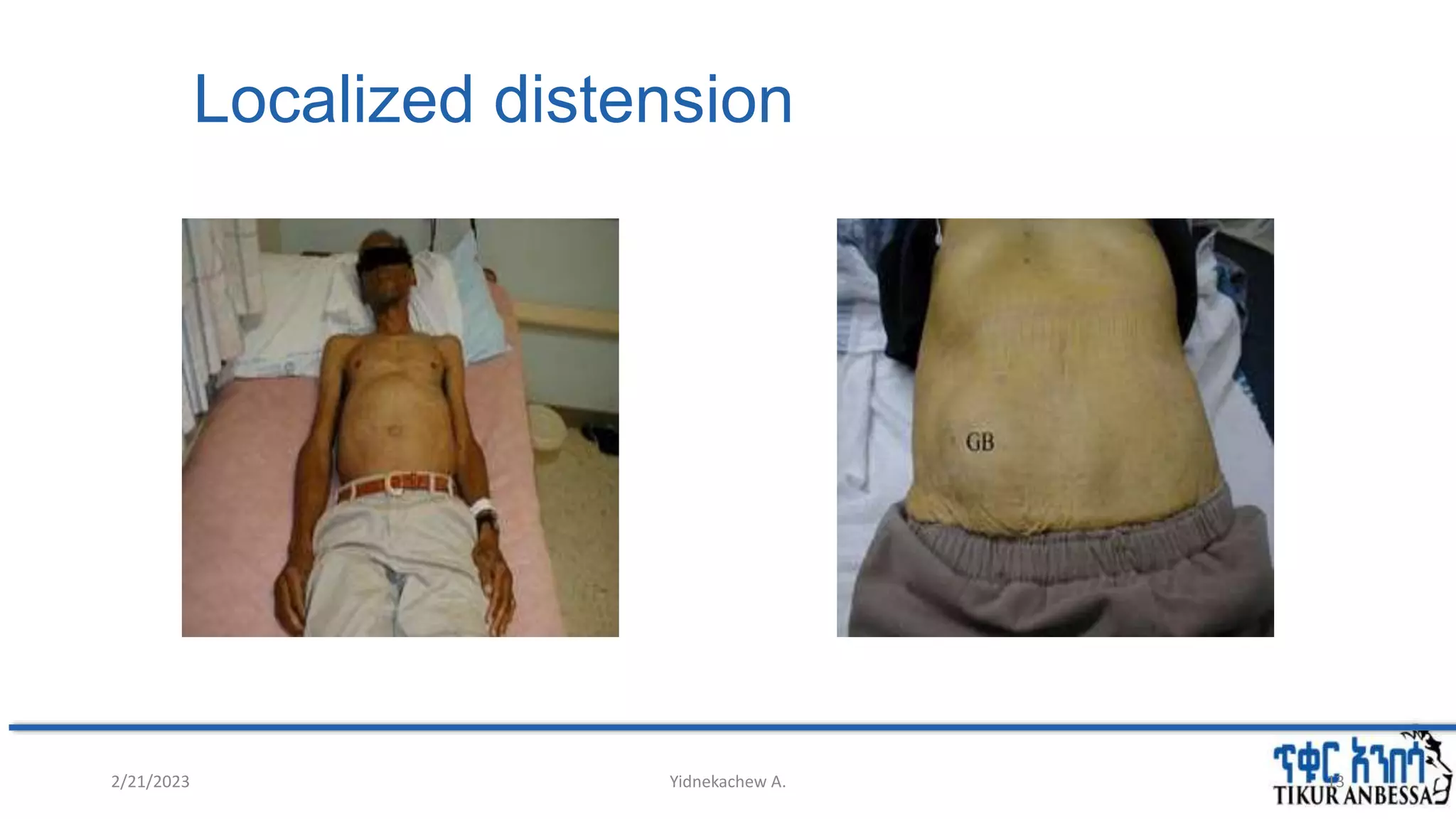 Chest, Abdomen and GUS.pptx