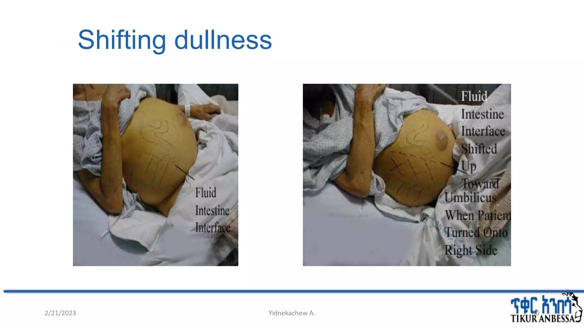 Chest, Abdomen and GUS.pptx