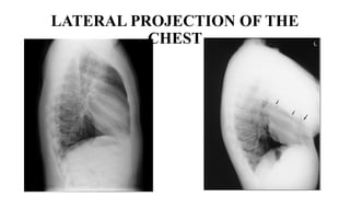 CHEST & ABDOMEN PRACTICAL PowerPoint Presentation | PPTX
