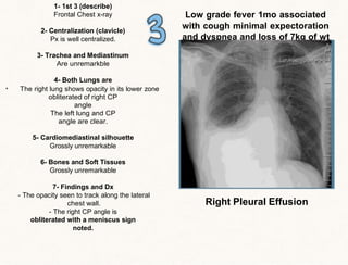 Chest and heart cases MD osce.pdf