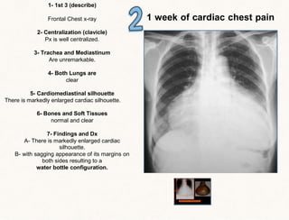 Chest and heart cases MD osce.pdf