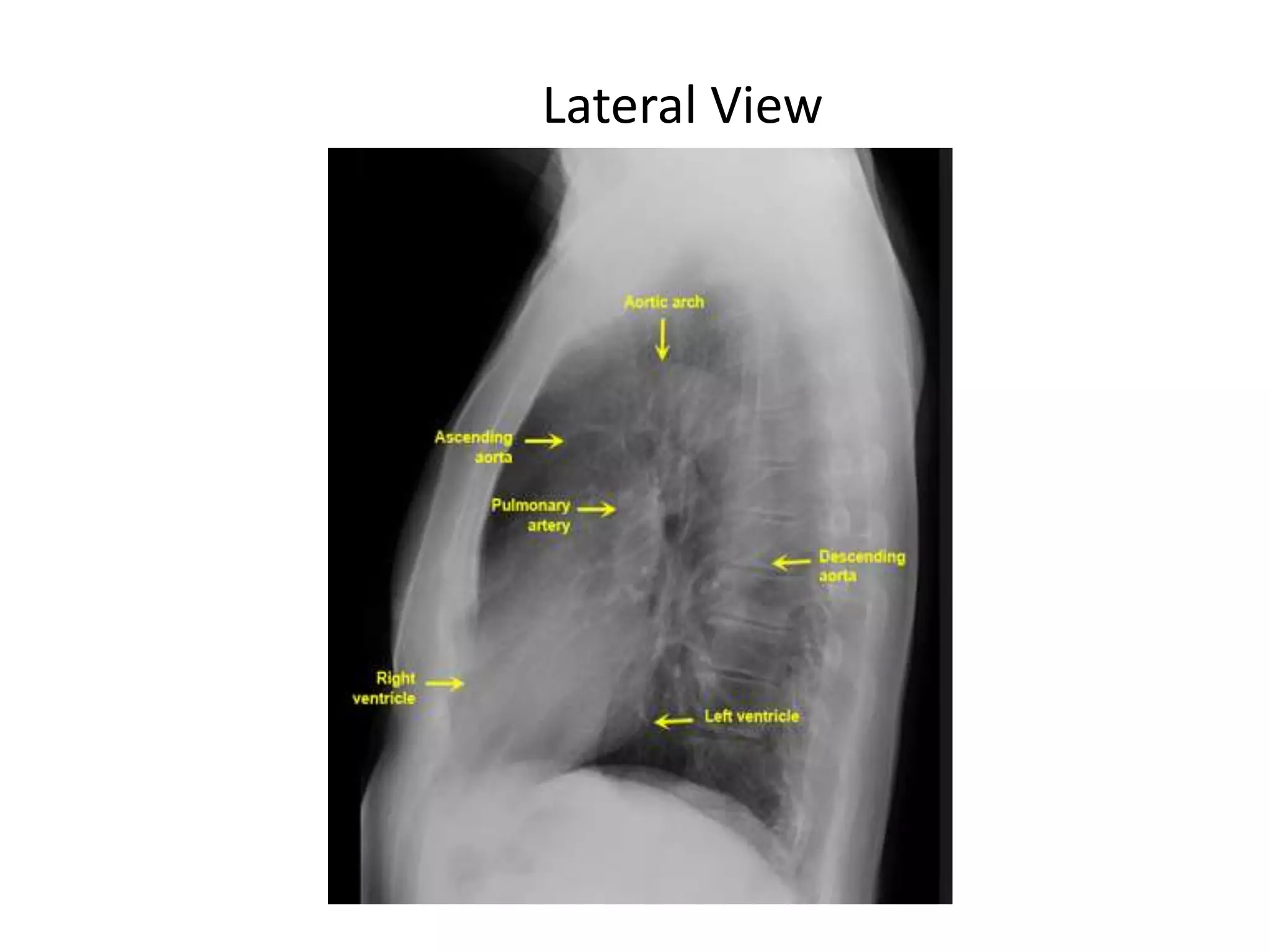 Chest basics + usg dr patil 21818 | PPTX