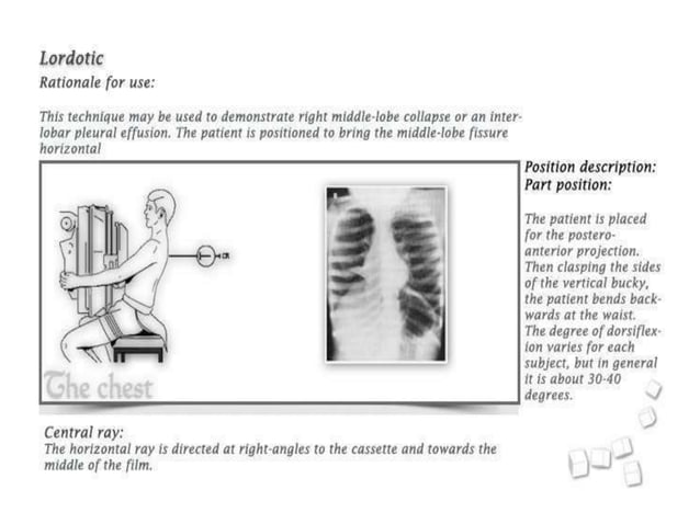 Chest basics + usg dr patil 21818 | PPTX