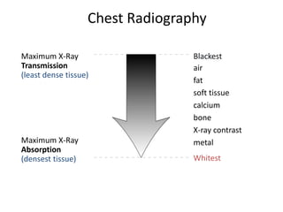 Chest basics + usg dr patil 21818 | PPTX