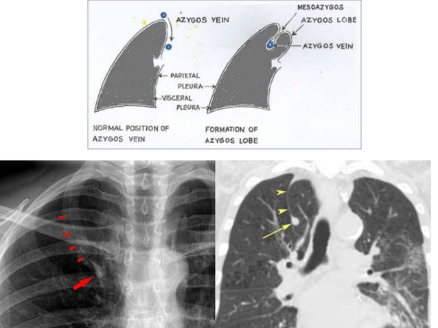 Chest basics + usg dr patil 21818 | PPTX