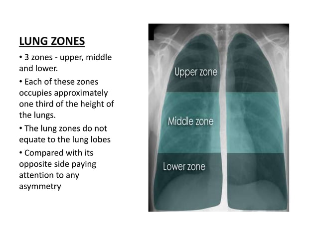 Chest basics + usg dr patil 21818 | PPTX