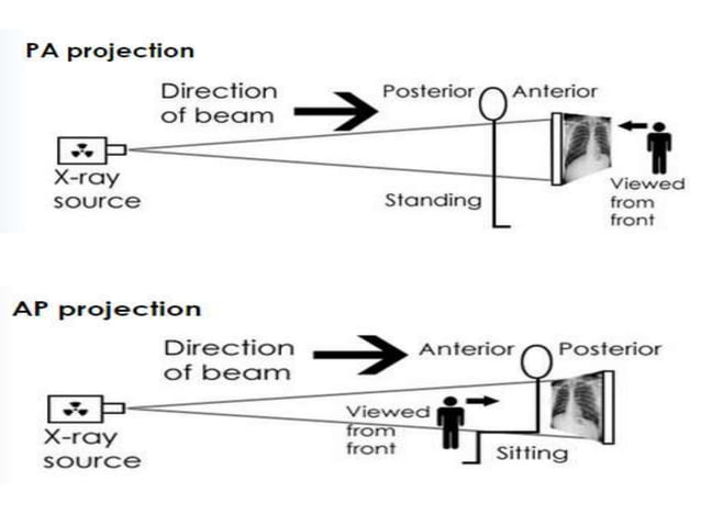 Chest basics + usg dr patil 21818 | PPTX