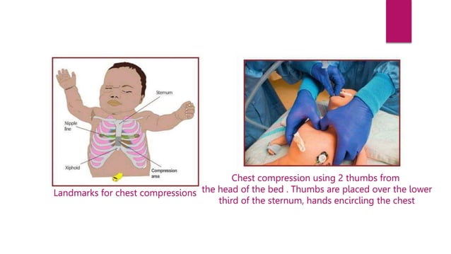 chest compression.pptx