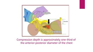 chest compression.pptx