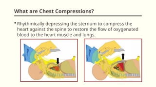 chest compressions in children (Basic Life Support) .pptx