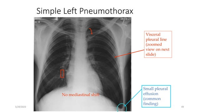 CHEST CONDITION-DCM 2021.pptx