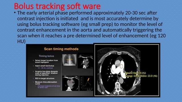 CHEST CT SCAN PRESENTATION FOR NEW RADIOGRAPHERS AND CT SCAN ...