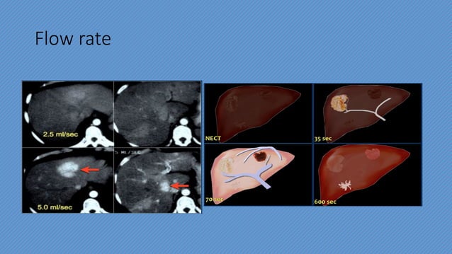 CHEST CT SCAN PRESENTATION FOR NEW RADIOGRAPHERS AND CT SCAN ...