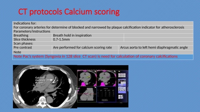 CHEST CT SCAN PRESENTATION FOR NEW RADIOGRAPHERS AND CT SCAN ...