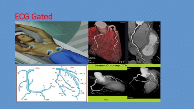 CHEST CT SCAN PRESENTATION FOR NEW RADIOGRAPHERS AND CT SCAN ...