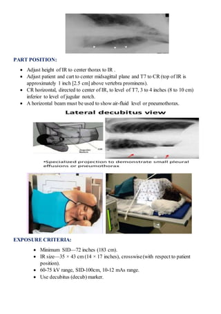 Chest decubitus | DOCX