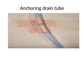 Chest Drainage.pptx..................... | PPTX | Lung and Respiratory ...