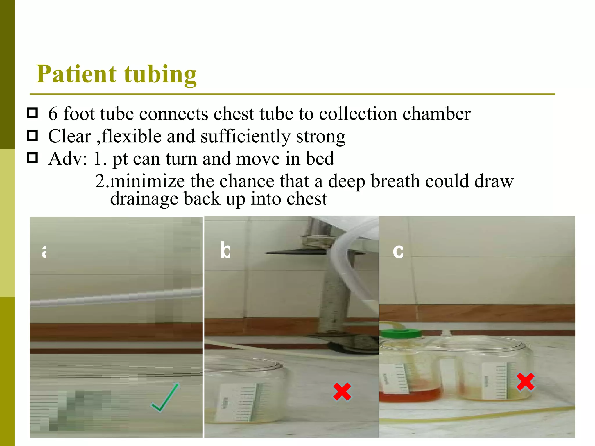 Chest Drains | PPT
