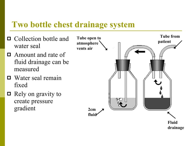 Chest Drains | PPT