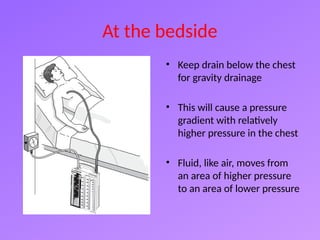 CHEST DRAINS for pleural effusion and also pneumothorax.pptx