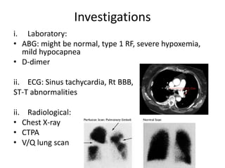 Chest emergencies | PPT
